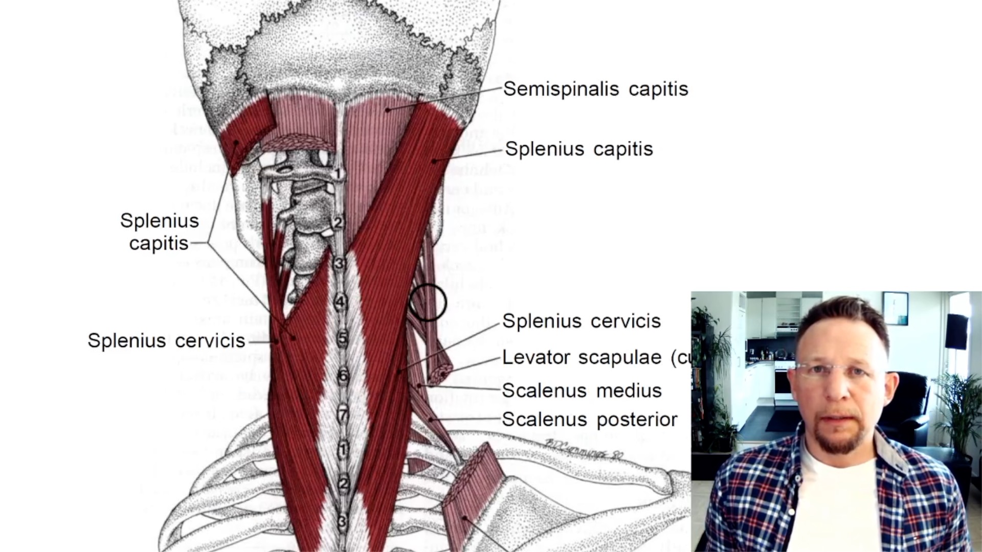 Triggerpisteet, osa 3: Niskan- ja ylärintarangan syvät lihakset ...